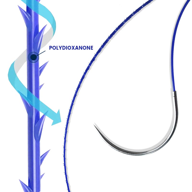 PDO Barb with a Loop Polyglycolic Surgical Sutures – Deenorathread